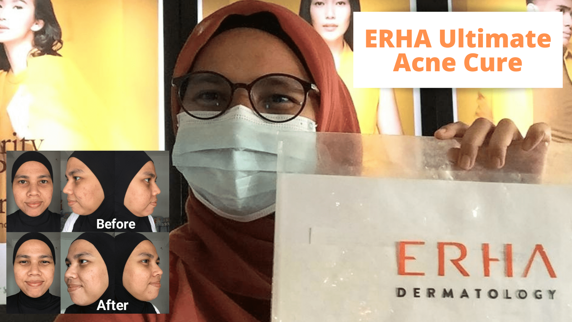 Pengalaman Mengatasi Jerawat dan Scars dengan ERHA Ultimate Acne Cure ...